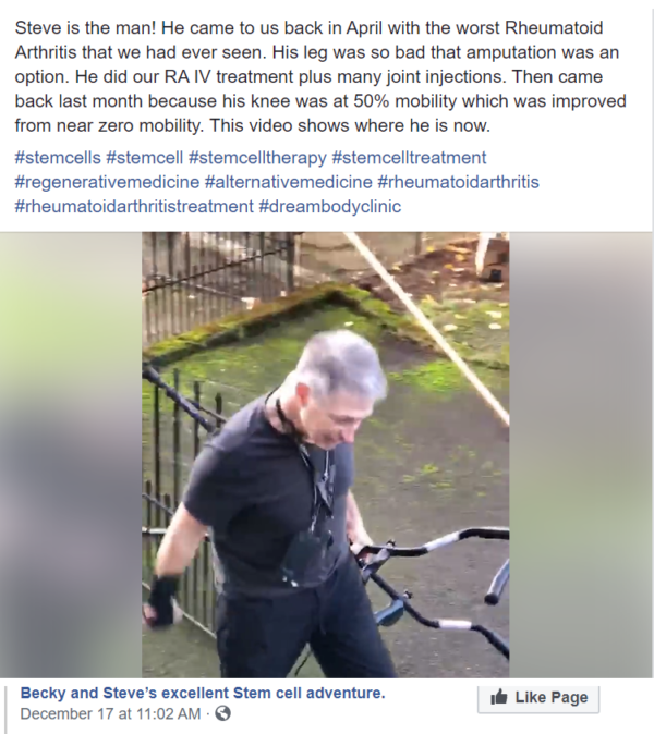 Rheumatoid Arthritis Stem Cell Treatment - Dreambody Clinic