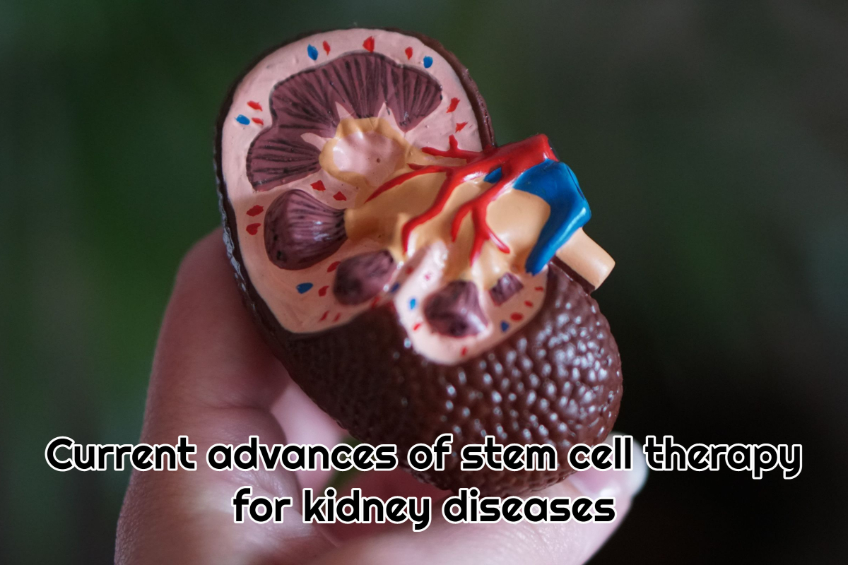 Current advances of stem cell therapy for kidney diseases - Dreambody ...