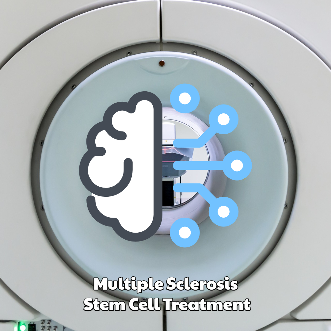 Multiple Sclerosis Stem Cell Treatment - Dreambody Clinic